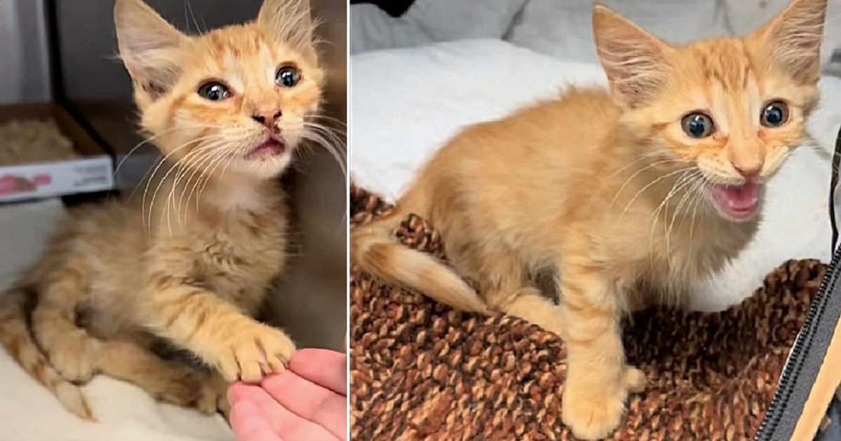 Winder Was Thrown From a Moving Car and Broke her Pelvis, But Love Has ...